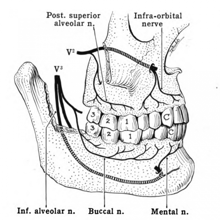 Trigeminal Nerve and Wisdom Teeth